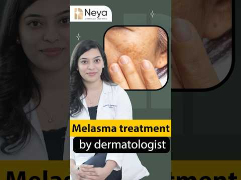 Melasma Treatment in Hyderabad | Dr. Ravali Yalamanchili